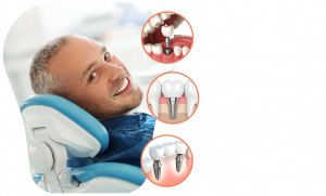 Dental Implant Surgery | Pittsburgh Precision Implants